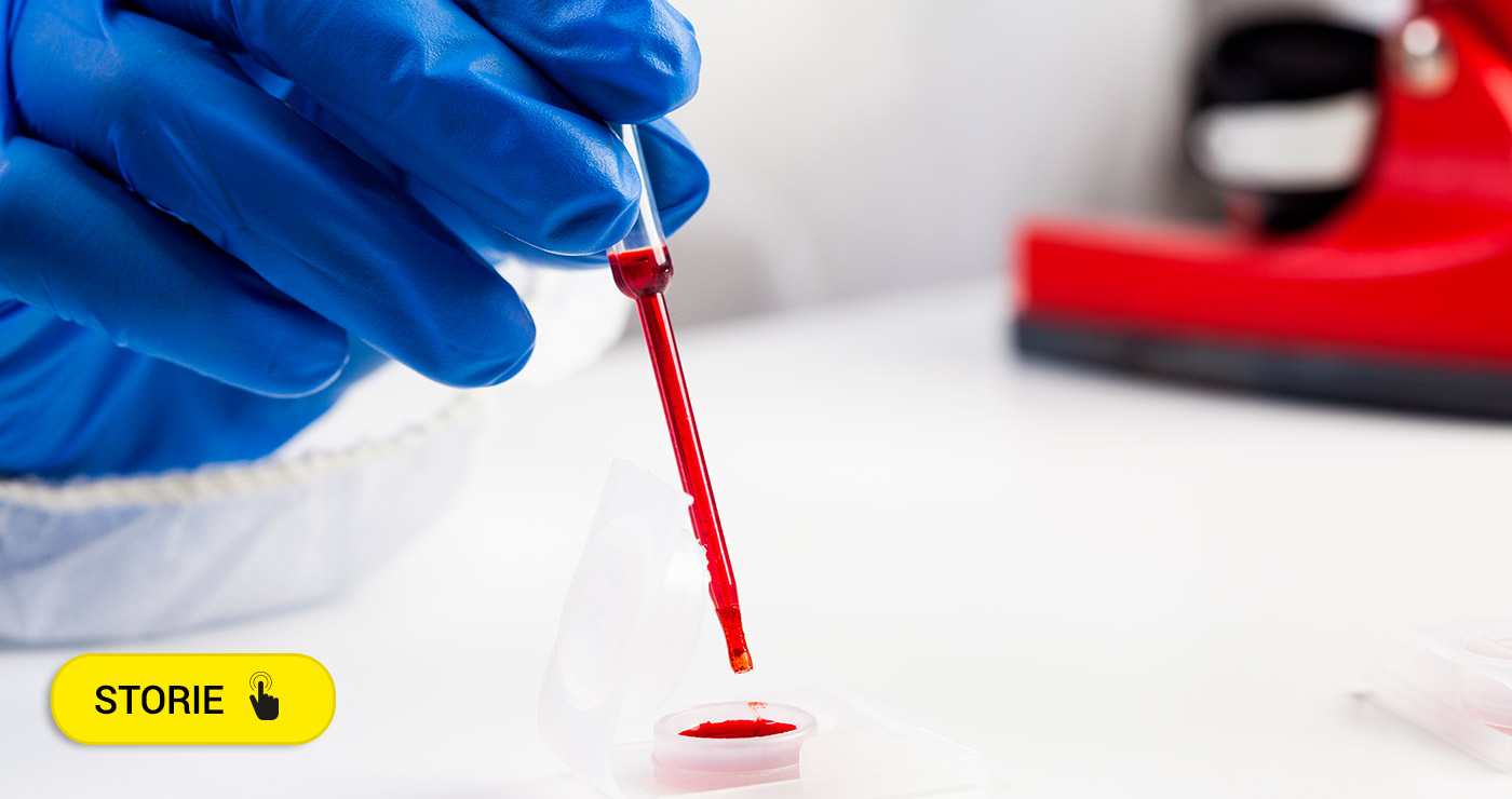 ¿Tuviste COVID y no te enteraste?